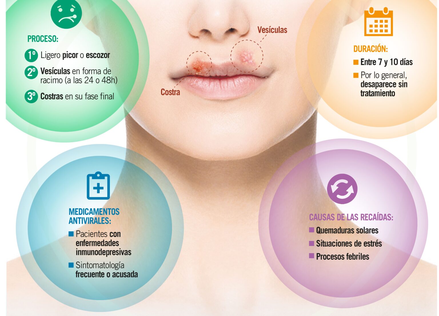 Cuánto dura el herpes labial - Diario Salamanca